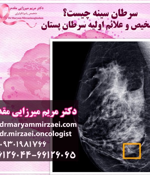 متخصص سرطان سینه دکتر مریم میرزایی مقدم