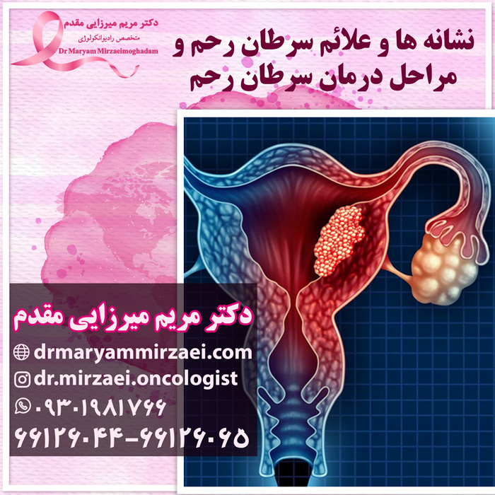 نشانه ها و علائم سرطان رحم و مراحل درمان سرطان رحم دکتر میرزایی مقدم